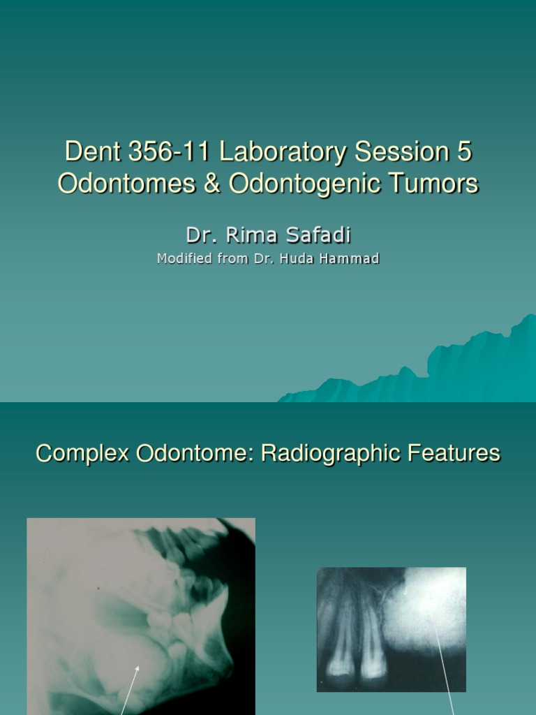 Odontomes & Odontogenic Tumors (Lab 6) | Epithelium | Anatomy