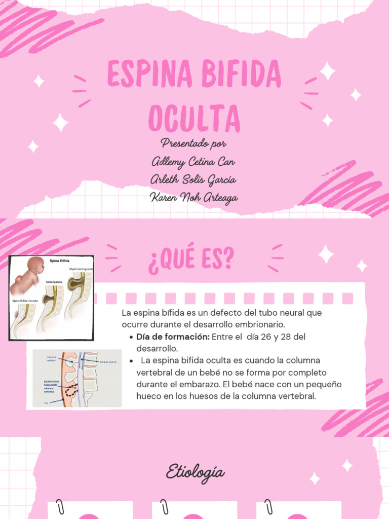 Espina Bífida Oculta: Causas y Tratamientos | PDF | El embarazo ...