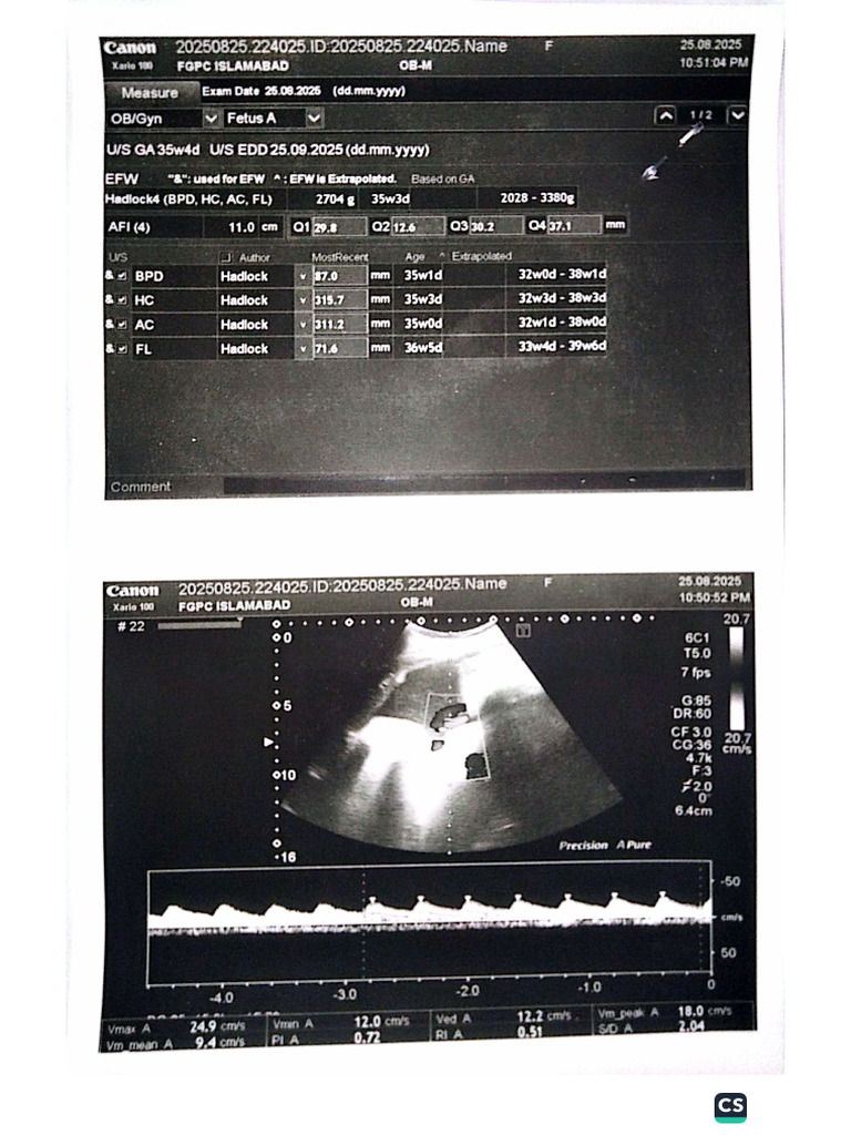 Ultrasound Report | PDF