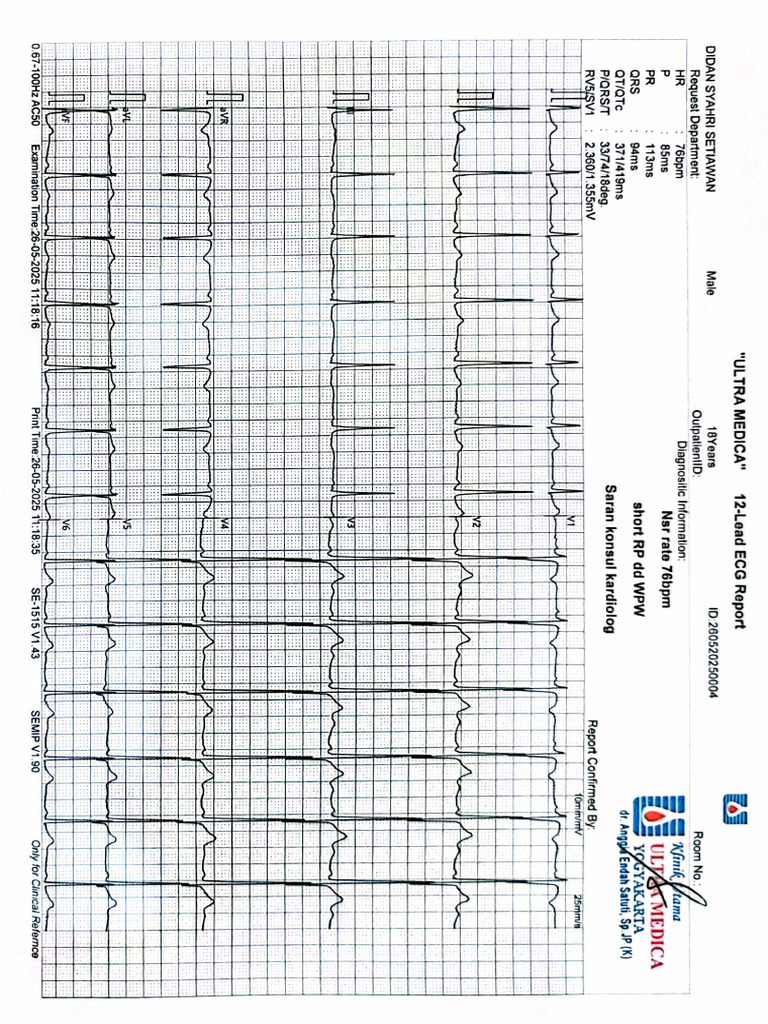 EKG Didan Syahri Setiawan. | PDF