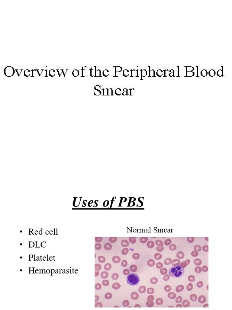 PBS | PDF | White Blood Cell | Anemia