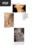 Cervical Lymph Node Mapping Guide | PDF