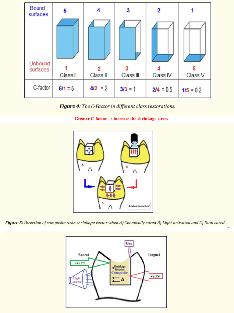C-Factor + Composite Shrinkage | PDF