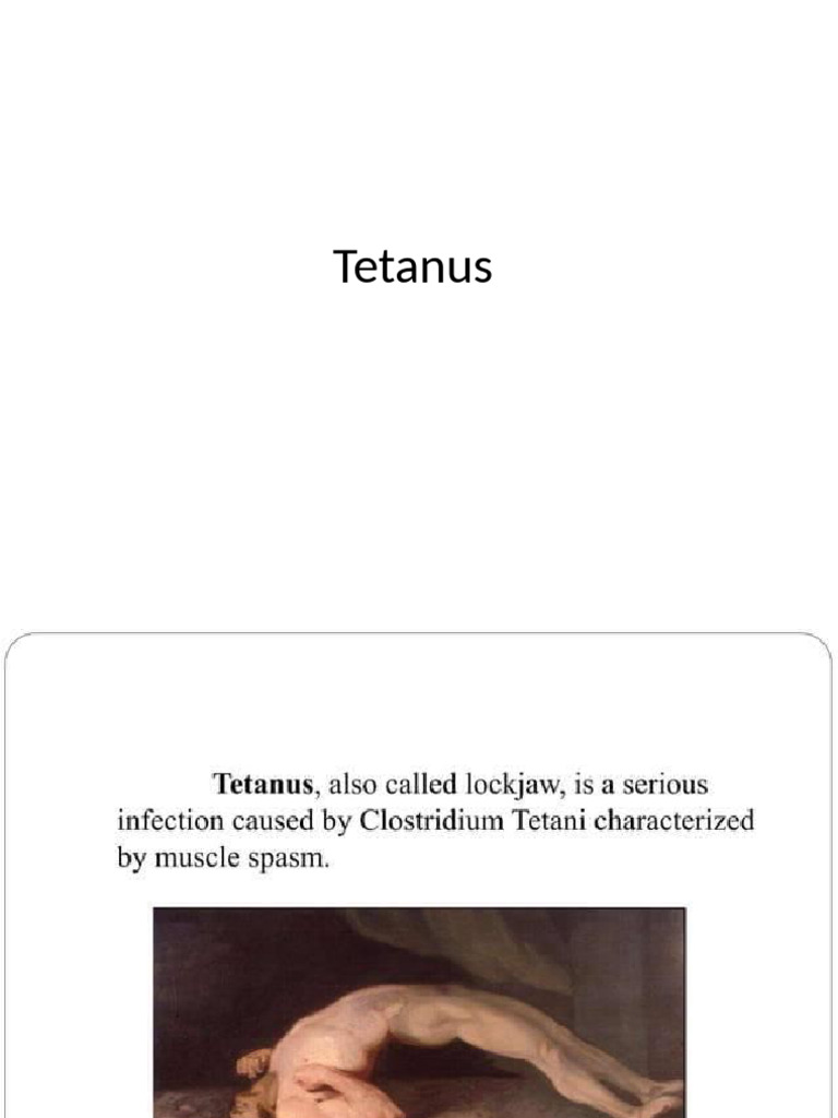 Tetanus | PDF