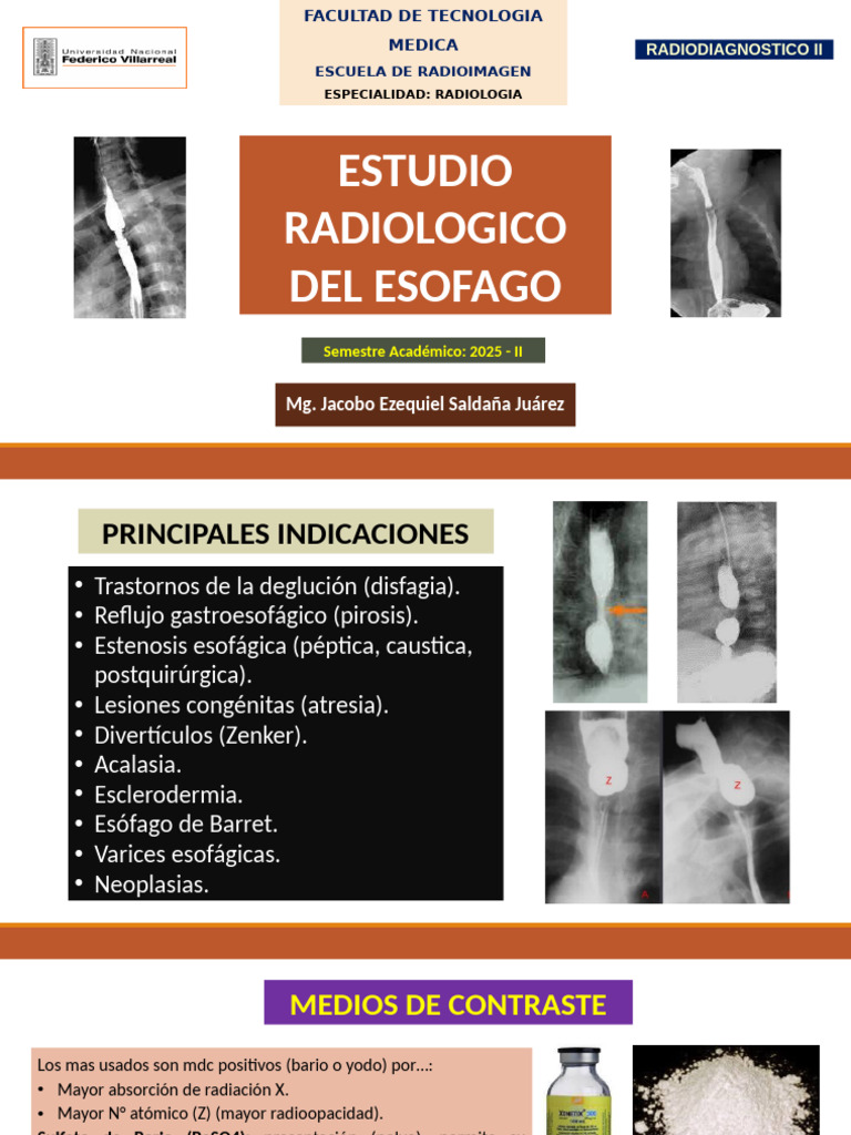 Estudio Radiológico del Esófago | PDF | La enfermedad por reflujo ...