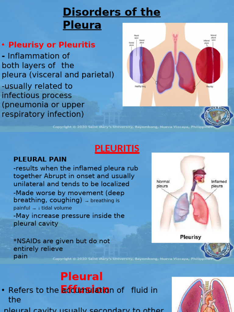 Disorders of The Pleura | PDF | Pulmonology | Clinical Medicine