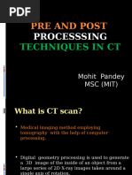 Understanding Pitch in CT Scans | PDF | Ct Scan | Imaging