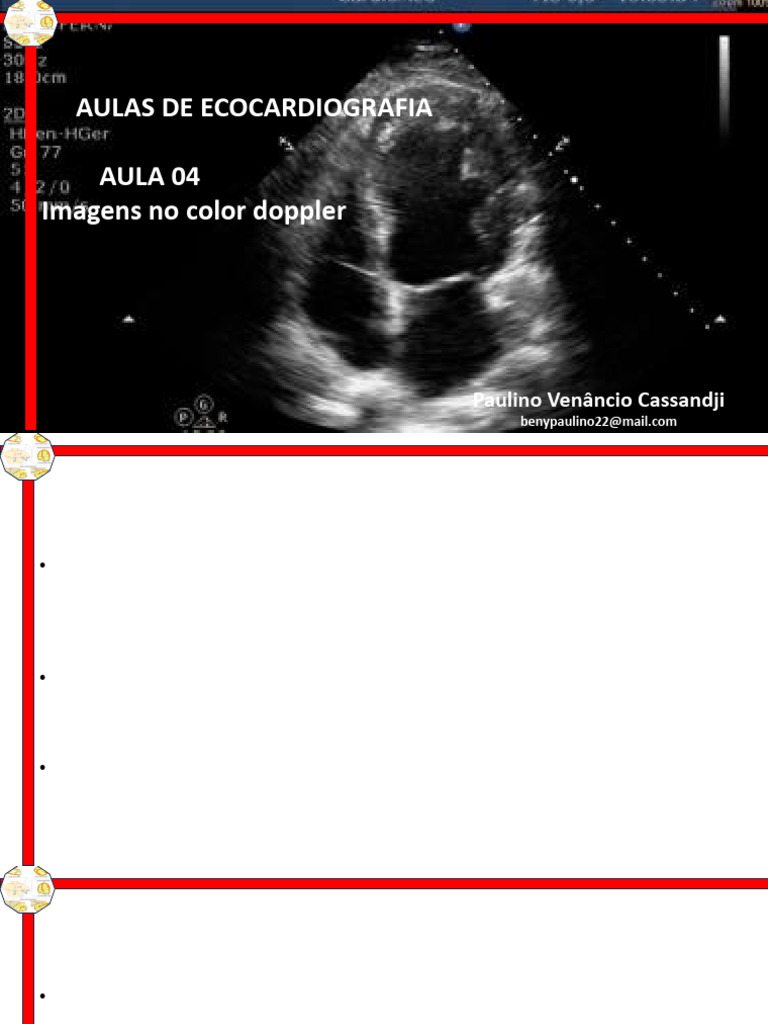 Ecocardiografia: Uso do Doppler Colorido | PDF | Ventrículo (coração ...