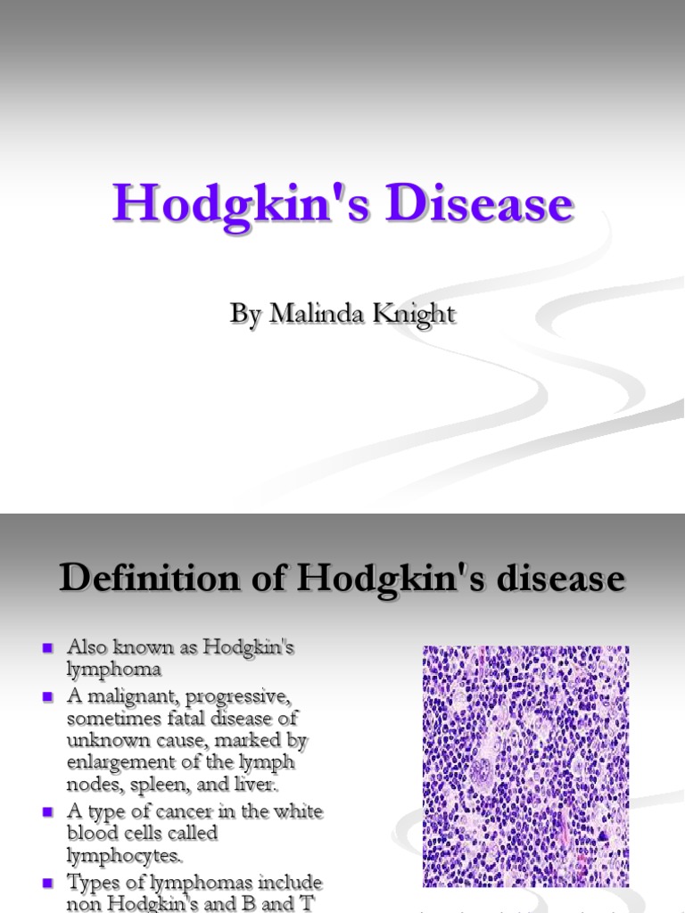 Hodgkin's Disease: by Malinda Knight | PDF | Lymphoma | Lymphatic System