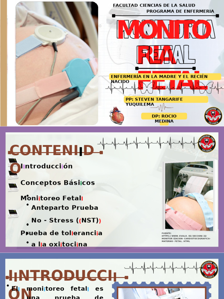 Monitoreo Fetal Electronico y Pruebas de Bienestar Fetal | PDF ...