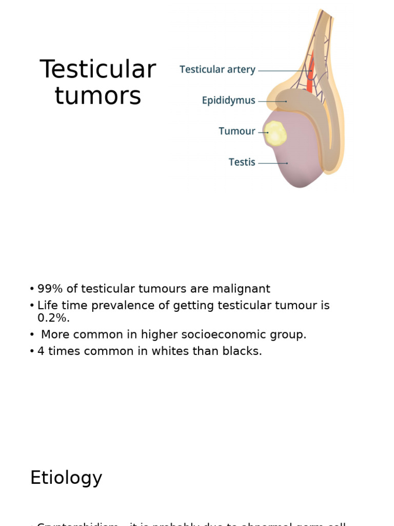 Testicular Tumor | PDF | Testicle | Neoplasms