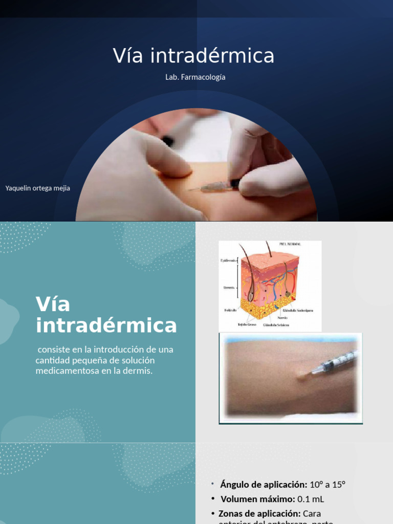 Dosis máxima en vía intradérmica | PDF | Inyección (medicina ...