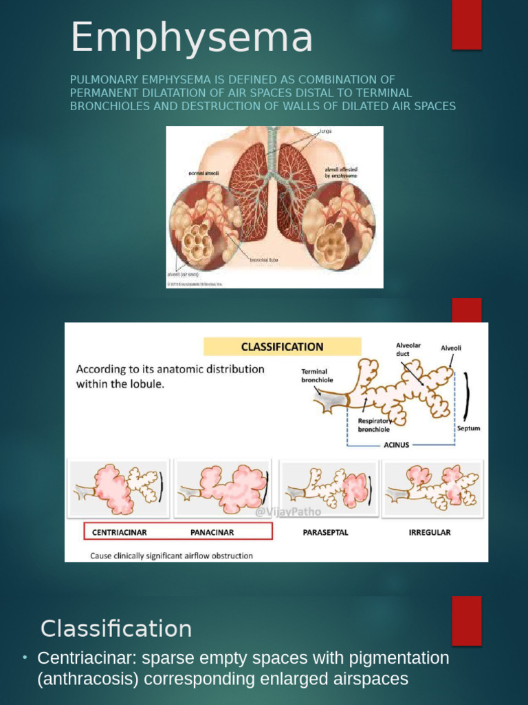 Emphysema - The Pathology of The Lung. | PDF | Lung | Clinical Medicine