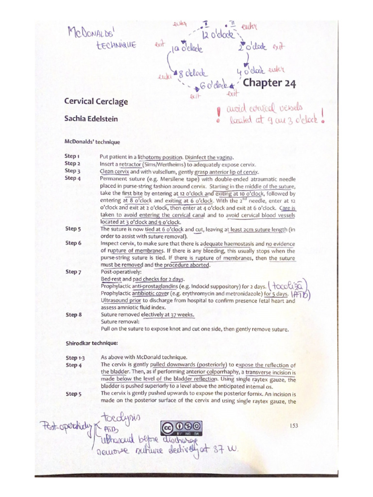 9.cervical Cerclage | PDF
