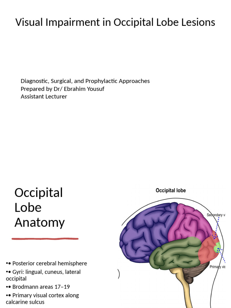 Visual Impairment in Occipital Lobe Lesions DR Ebrahim Yousuf 1 | PDF | Occipital Lobe | Visual ...