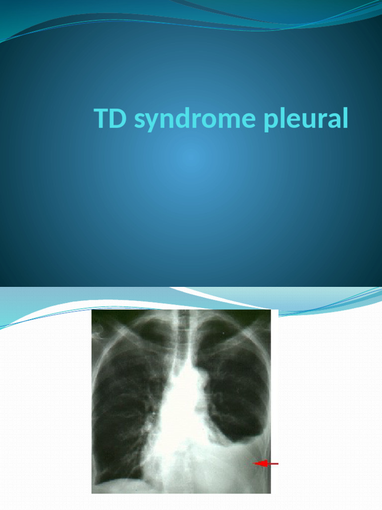 TD Syndrome Pleural | PDF