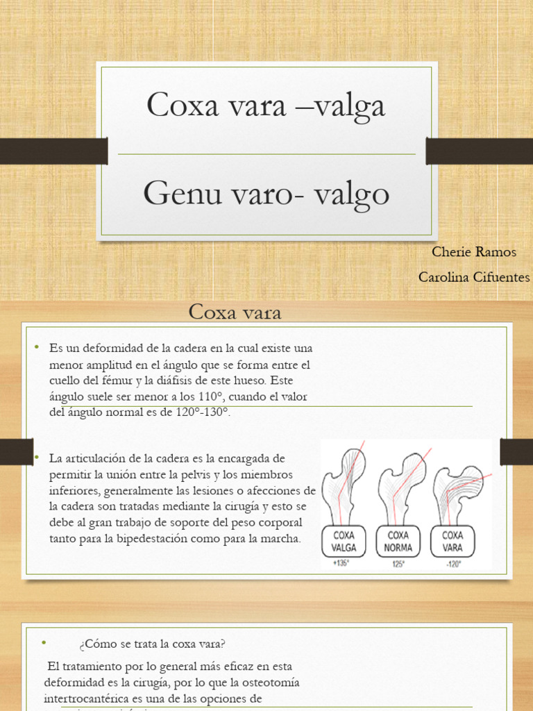 Coxa Vara y Genu Valgo: Causas y Tratamiento | PDF | Rodilla ...