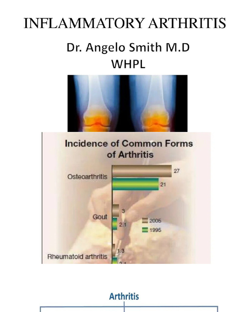 Inflammatory Arthritis | PDF