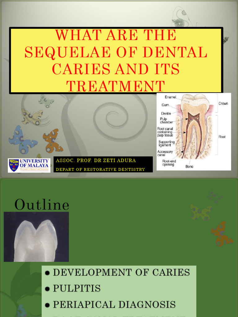 Sequelae and Treatment of Dental Caries | PDF | Mouth | Medical Specialties