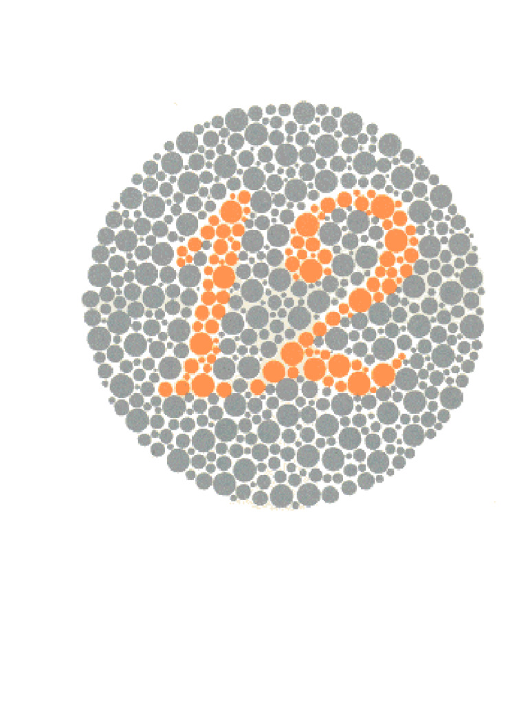 Ishihara Color Blindness Test Plates | PDF