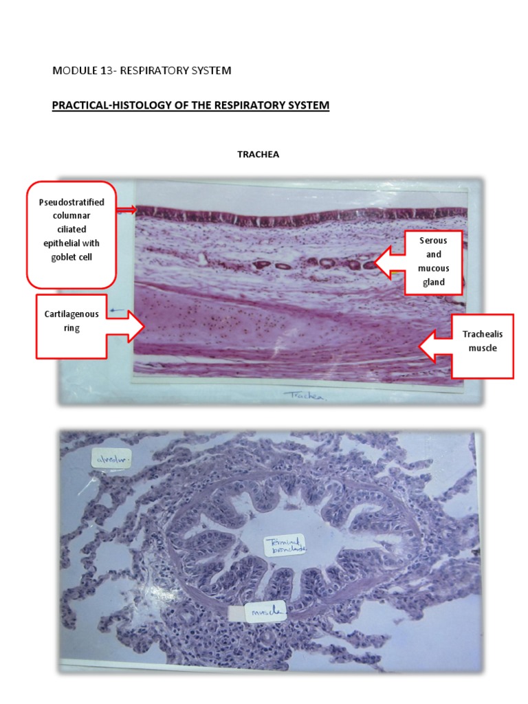 Practical Histology - Respiratory System | PDF Practical Histology - Respiratory System | PDF