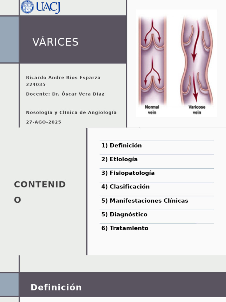 Várices: Causas, Diagnóstico y Tratamiento | PDF | Angiología | Venas ...