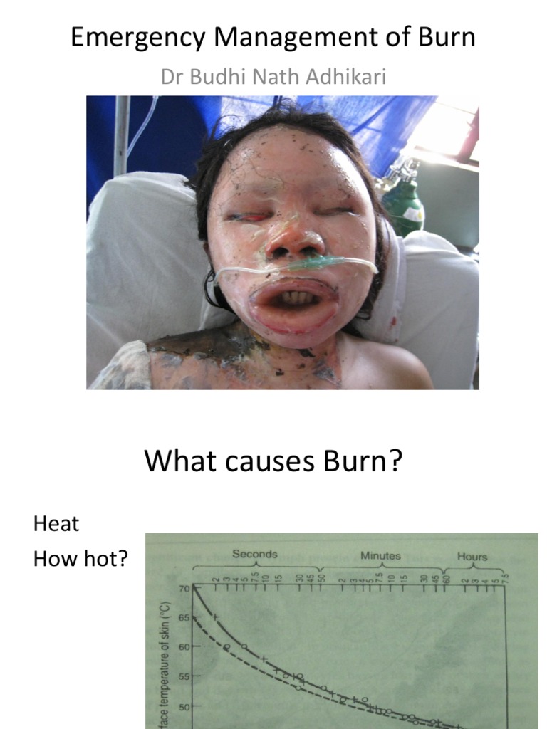 Emergency Burn Management Protocols | PDF | Burn | Sepsis