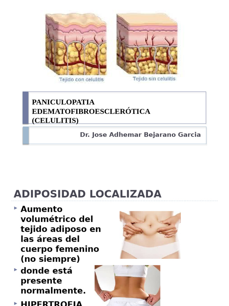Celulitis-Pefe Adhe | PDF | Examen físico | Tejido adiposo