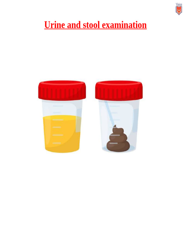 Pathology II Chapter 7 - Clinical Pathology II Urine and Faeces | PDF ...