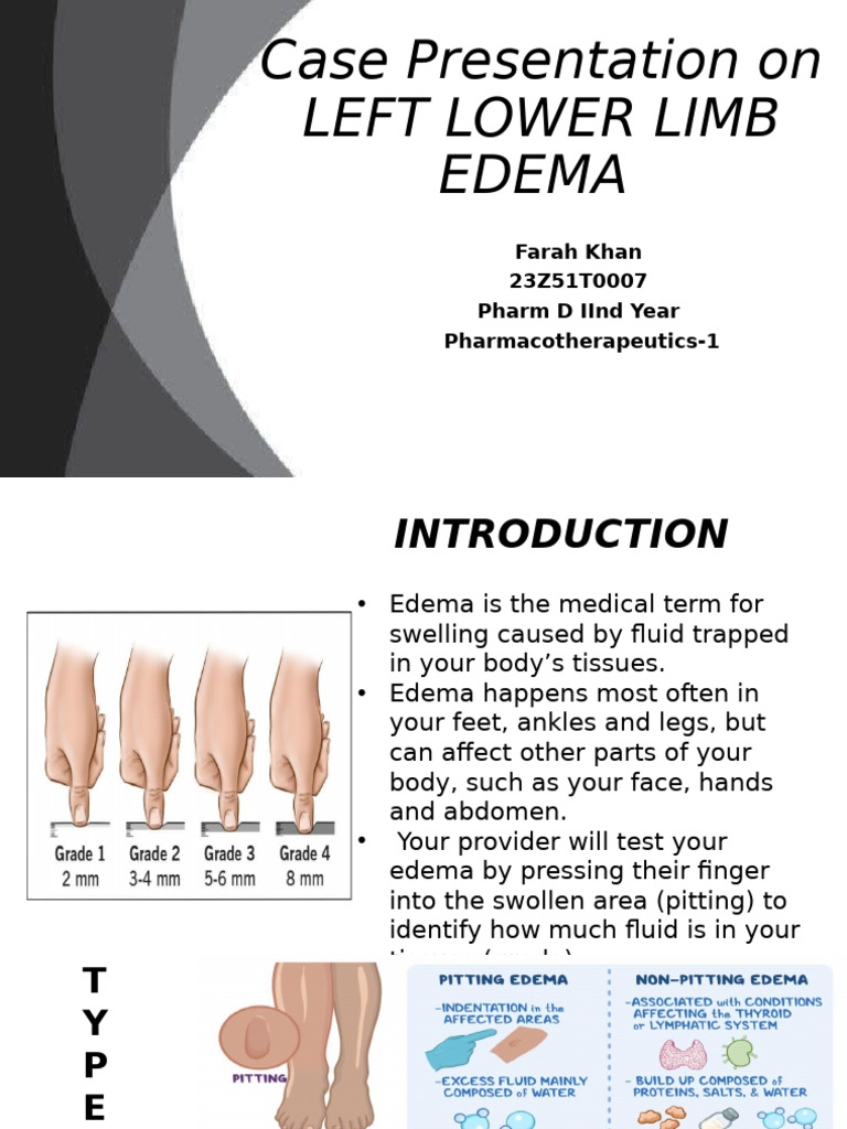 Left Lower Limb Edema | PDF | Edema | Medicine