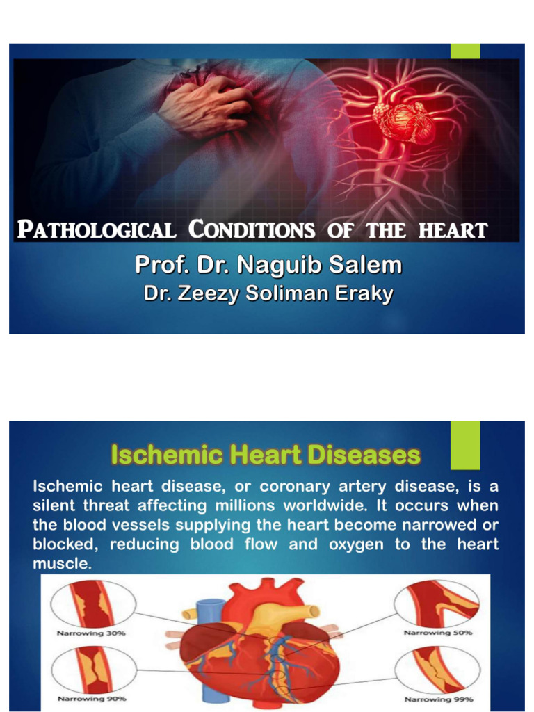 Pathological Conditions of The Heart | PDF
