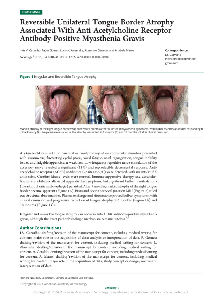 Carvalho Et Al 2024 Reversible Unilateral Tongue Border Atrophy ...