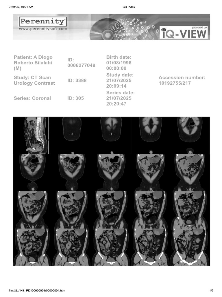 CT SCAN 4 | PDF