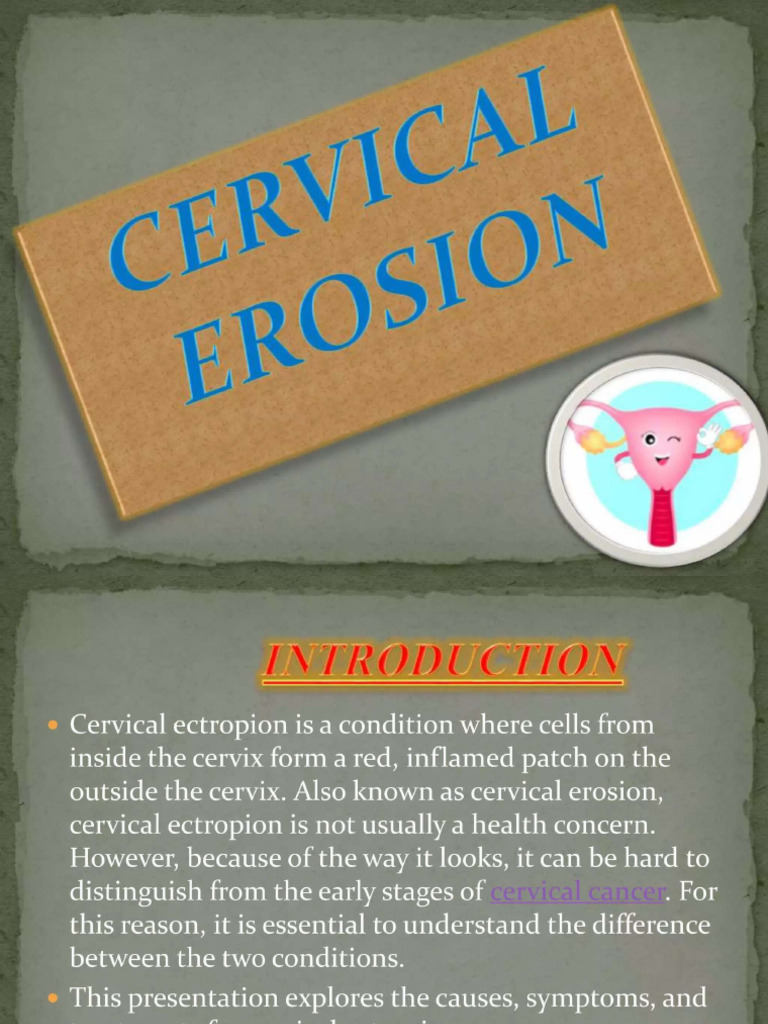 9.Cervical Erosion | PDF