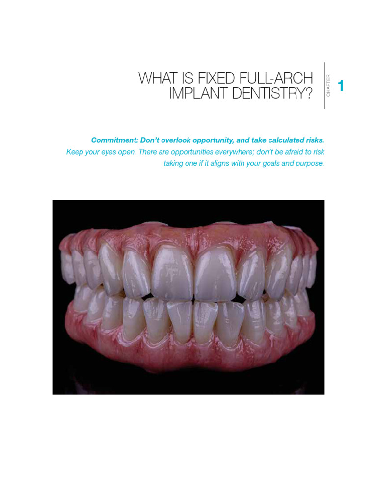 What Is Fixed FULL-ARCH Implant Dentistry (A Smile Where There Was None ...