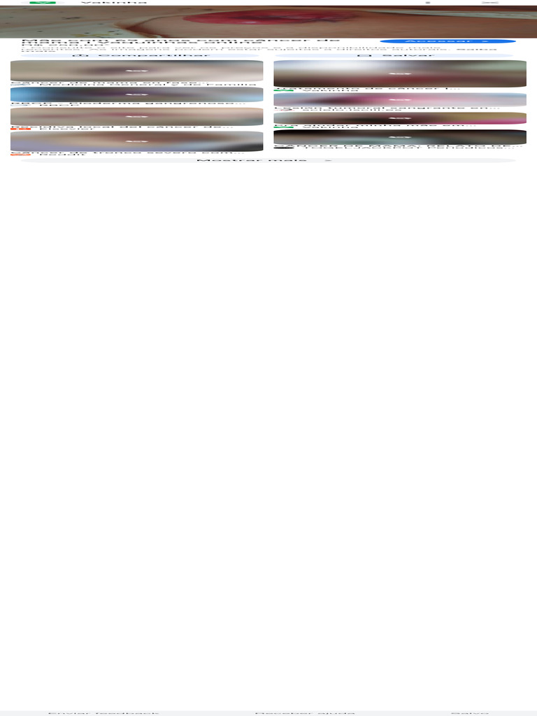 Cancer de Mama Com Ferida Benigno Drenando - Pesquisa Google | PDF ...