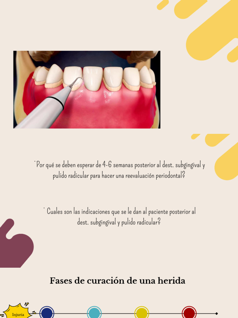 Presentación Perio II - 20250610 - 075055 - 0000 | PDF | Curación ...