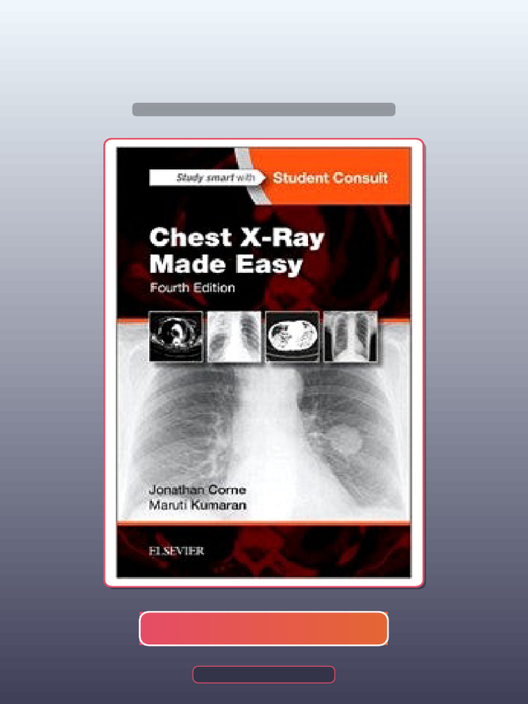 Ultimate Bundle Chest XRay Made Easy 4th Edition eBook and TestBank ...