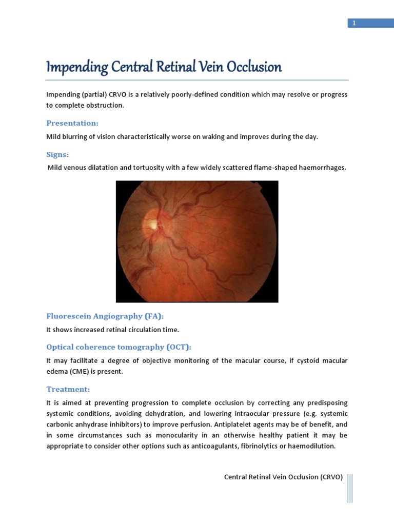 Non-Ischemic Central Retinal Vein Occlusion | PDF | Retina | Ischemia