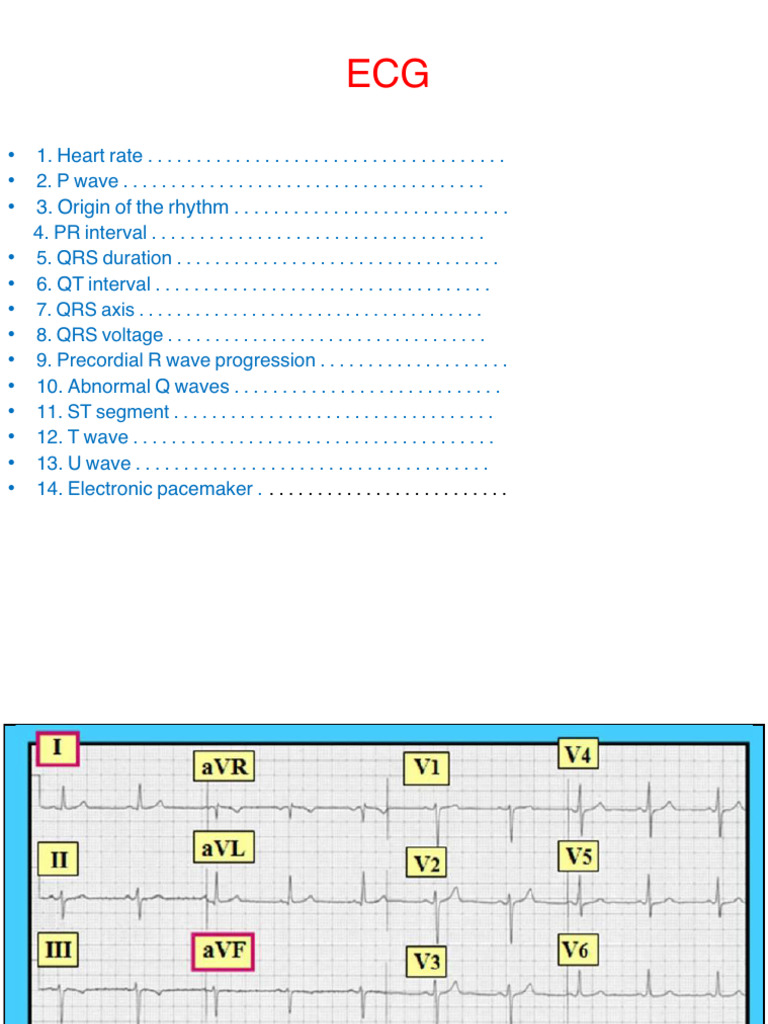 Ecg Presentation | PDF