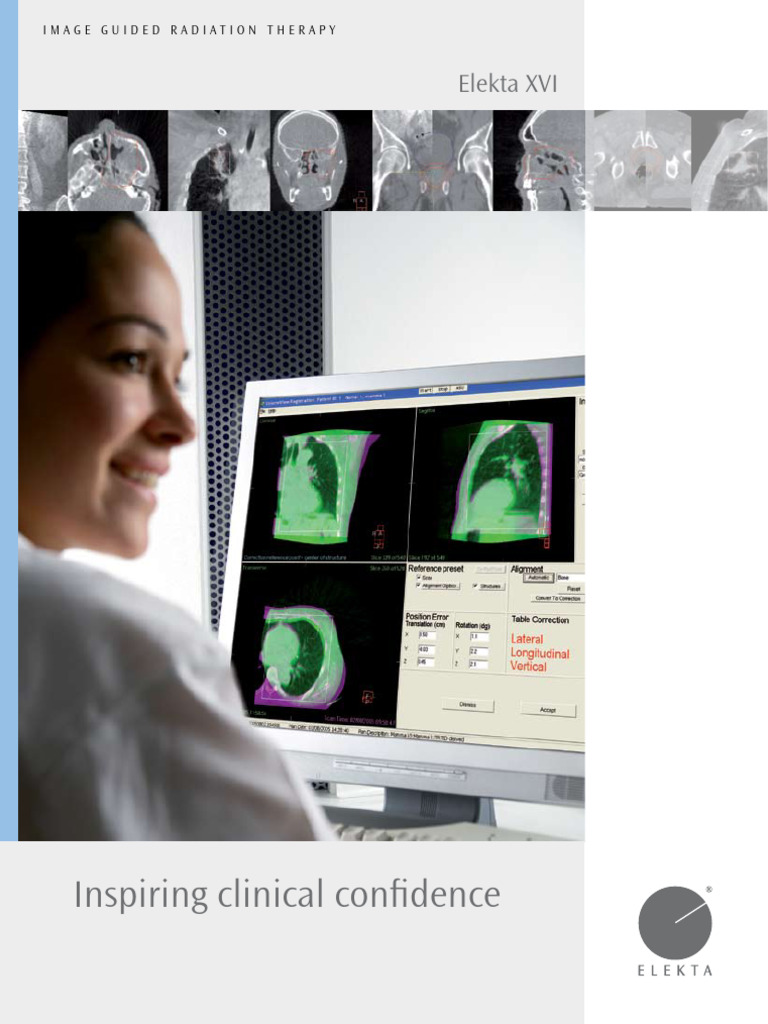 Elekta XVI: Precision in Radiation Therapy | PDF | Radiation Therapy ...