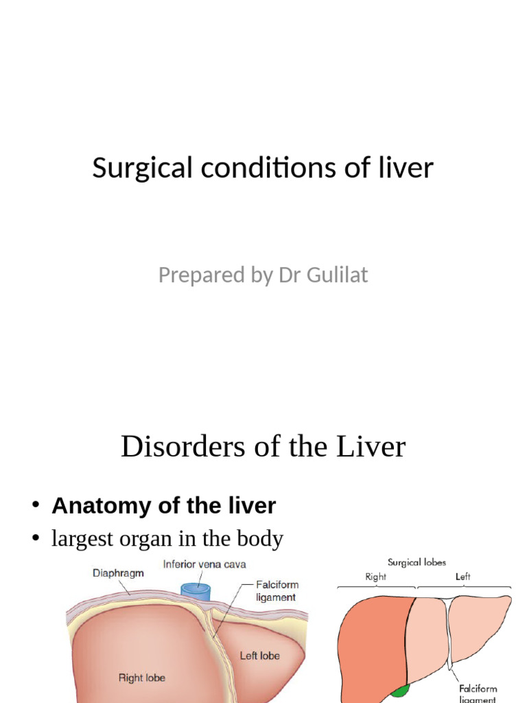 Liver Surgical Conditions Overview | PDF | Liver | Medical Specialties
