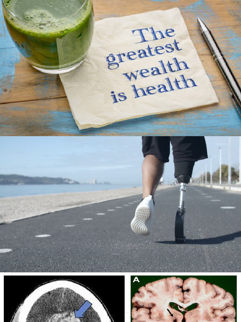 Health Is The Greatest Wealth | PDF