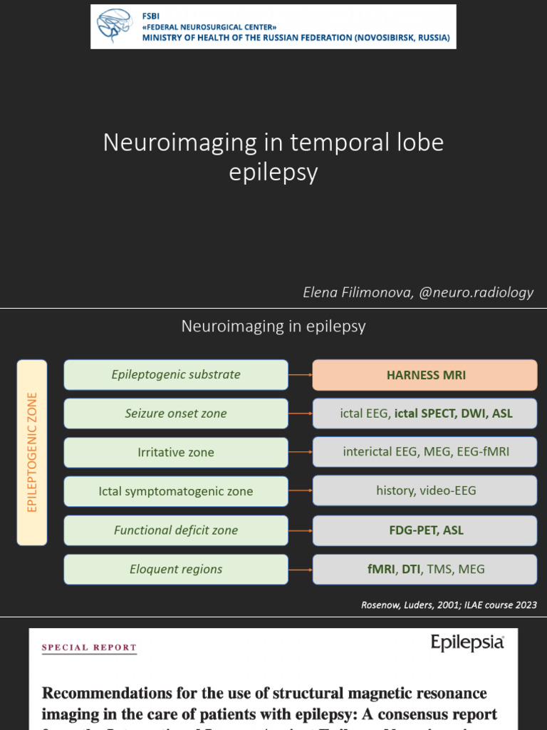 Neuroimaging in Temporal Lobe Epilepsy | PDF | Neuroimaging | Epilepsy