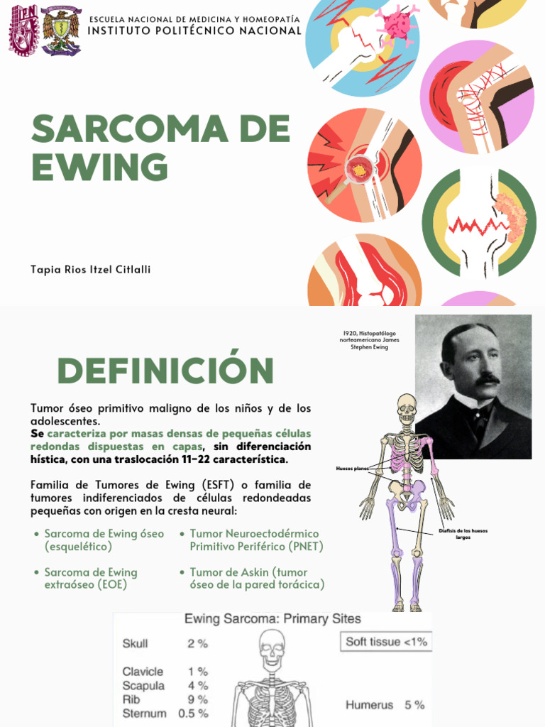 Sarcoma de Ewing .TUMOR de Celulas Pequeñas Redondas Azules. | PDF ...