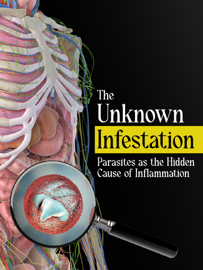 The Unknown Infestation - Parasites As The Hidden Cause of Inflammation ...