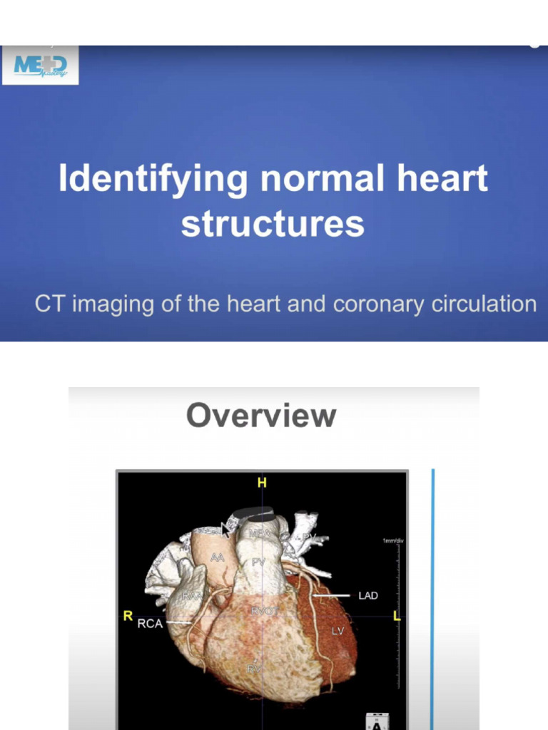 Cardiac CT Structures | PDF