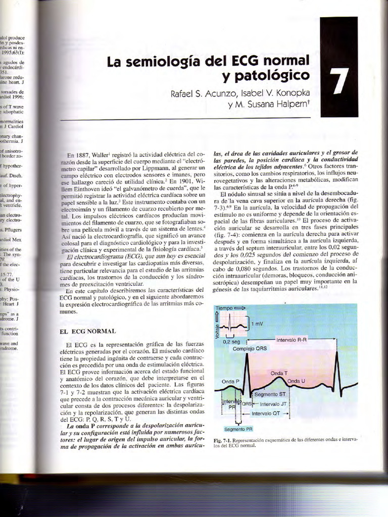Semiologia de ECG2 | PDF