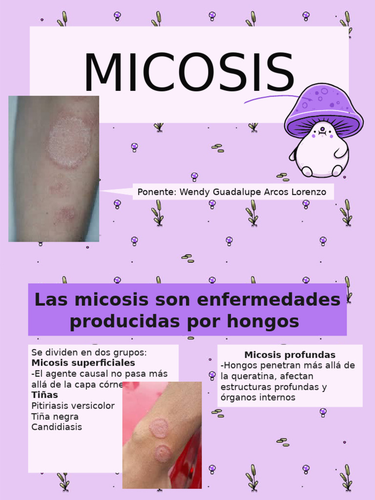 Micosis y Dermatitis Genital | PDF | Enfermedades y trastornos humanos ...