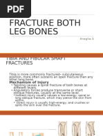 Types of Orthopedic Casts Explained | PDF | Knee | Ankle